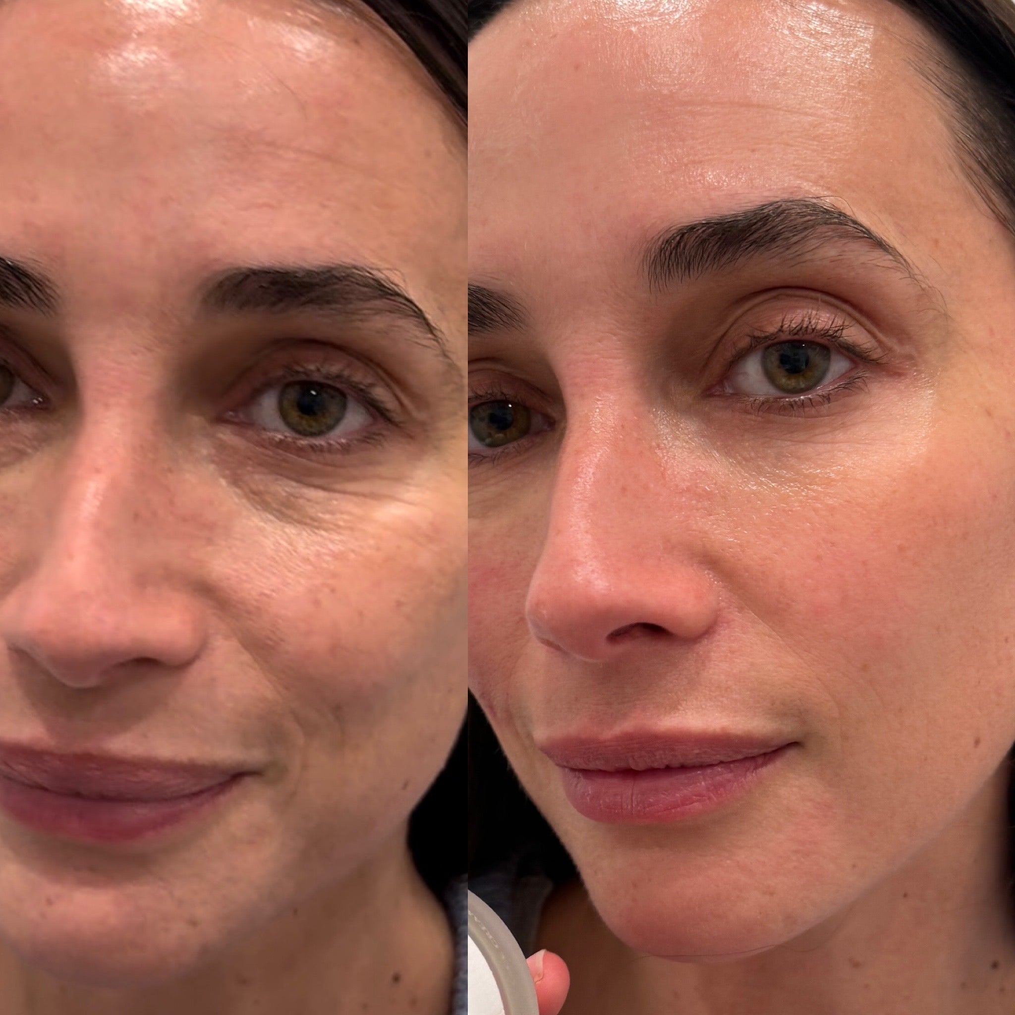 Before & After MACRENE actives Actress Rebecca Dayan - The High Perfor ...