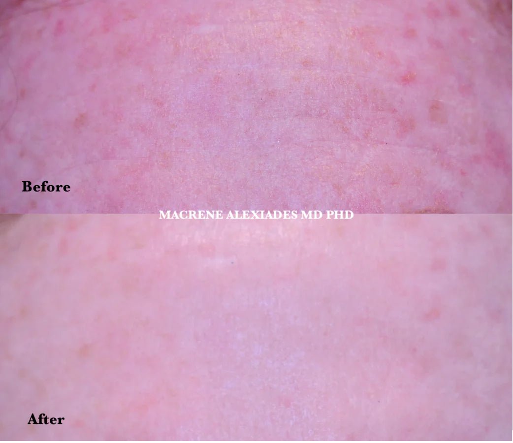 Sun Damaged Skin – DR. MACRENE actives